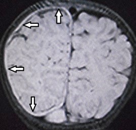Annals of Case Reports and Medical Images